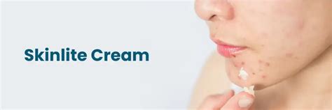 Skinlite Cream Complete Guide On Uses And Benefits