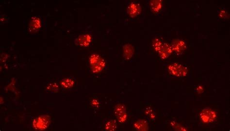 荧光原位杂交技术（fish）显微成像方案 明美光电