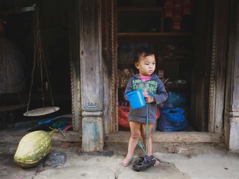 Young Mania Rating Scale Ymrs Photos Download The Best Free Young