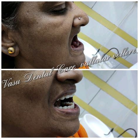 Dr Vasu Devan Posted On Linkedin