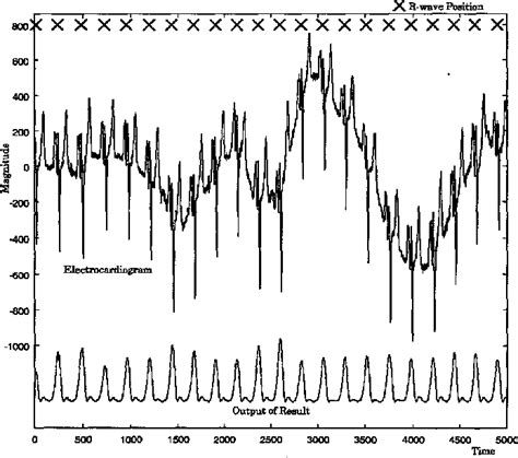 Figure 7 From A Waveform Detection Algorithm Using Modulation System