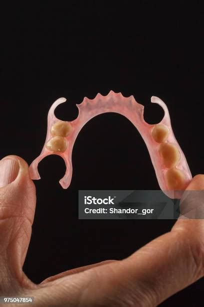 Prostesis Gigi Di Tangan Dokter Gigi Foto Stok Unduh Gambar Sekarang