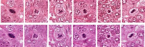 Figure 312 From Automated Mitosis Detection In Color And Multi