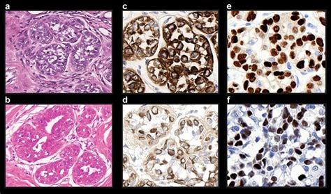 Comparison Of Post Um And Routinely Processed Ffpe Samples Acquired