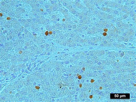 Human Liver Tissue Normal Ffpe Sections