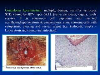 Diseases Of The Female Reproductive System Ppt