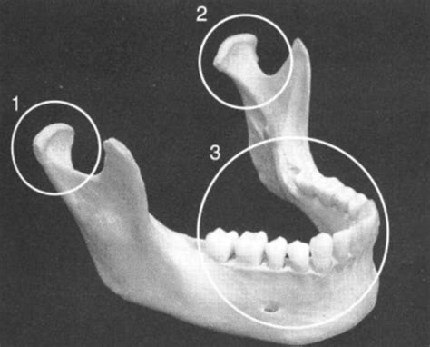 2 Esthetics And Dental Occlusion Flashcards Quizlet