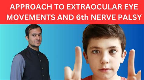 Sixth Cranial Nerve Palsy Examination Extraocular Eye Movement