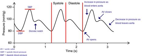 Arterial Pressure Monitoring Treatment And Management Point Of Care