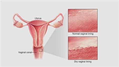 Outer Vaginal Itching