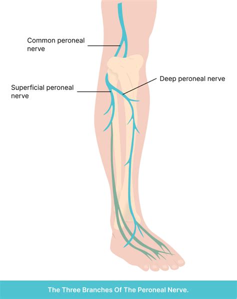 Peroneal Nerve Dysfunction Causes Symptoms And Treatments