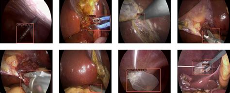 Several Samples Of Our Detection Work Download Scientific Diagram