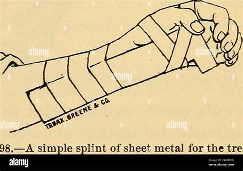 Metacarpo Phalangeal Joint Banque De Photographies Et Dimages à Haute Résolution Alamy