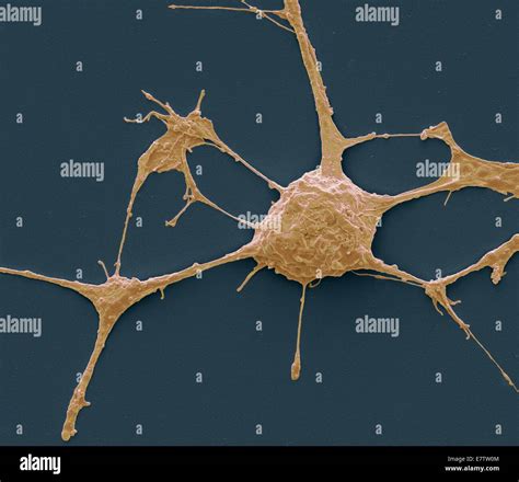 Neurone Scanning Electron Micrograph Sem Of A Pc12 Neurone In Stock