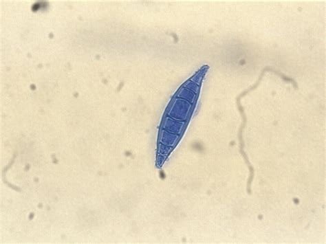 Microsporum Canis Macroconidia