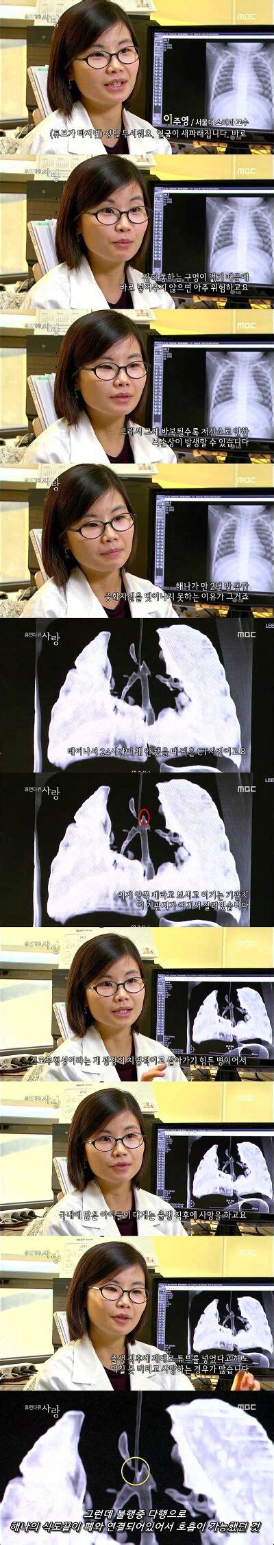 김짤닷컴 기도 없이 태어난 아기를 수술해준 의사