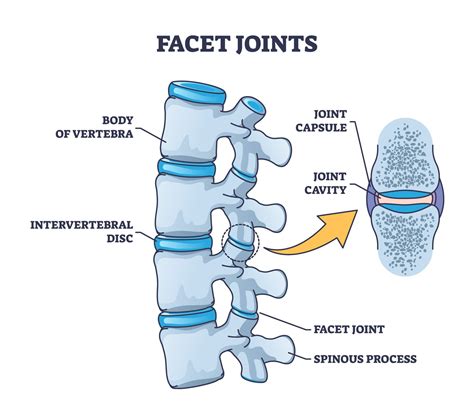 Facet Joint Syndrome Symptoms Causes Types And Treatment