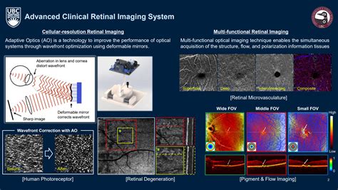 Computational Opthalmic Imaging Lab Coil Slide 2
