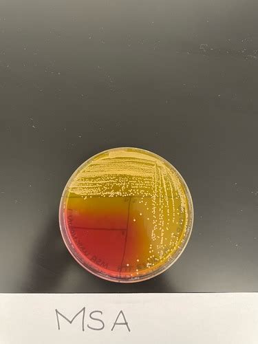 Lab Selective And Differential Media Flashcards Quizlet