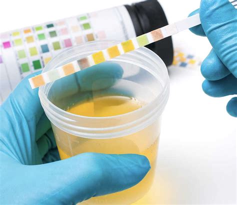 Hellp Syndrome What Is Hellp Syndrome