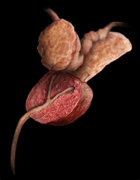 Prostate Dr Qaisar Ahmed Md Dhms
