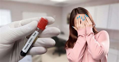 How Long Should I Wait To Get Tested For STDs