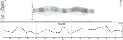 An Example Of A Gamma Analysis On An Arccheck Phantom Using Trajectory
