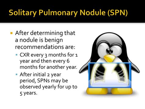 PPT Solitary Pulmonary Nodule PowerPoint Presentation Free Download ID 6722178