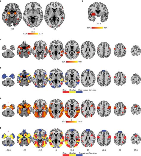 Ale And Anm Results Of Emotion General Expression Processing A Ale Download Scientific Diagram