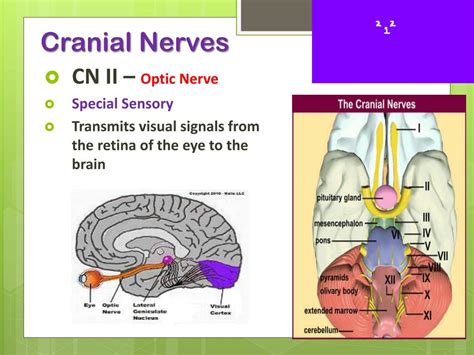 Cranial Nerve Deficit