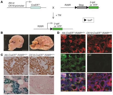 Jci Intrahepatic Cholangiocarcinoma Can Arise From Notch Mediated Conversion Of Hepatocytes
