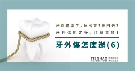 牙外傷怎麼辦6牙齒撞歪了，拉出來？推回去？牙齒固定後的注意事項 顯微根管治療張添皓醫師