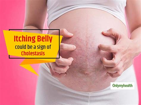 Intrahepatic Cholestasis Of Pregnancy
