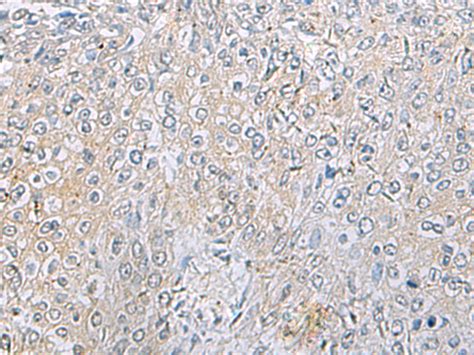 兔抗cxcl1多克隆抗体anti Cxcl1 Rabbit Polyclonal Antibody 生命科学产品与技术服务 生工生物工程