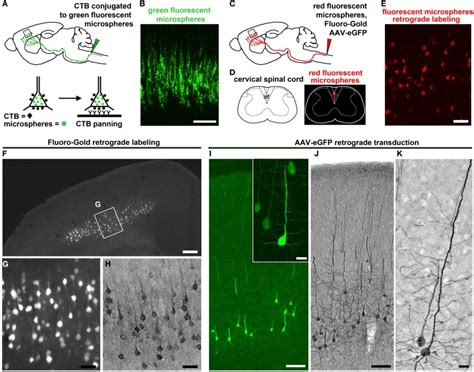 Csmn Retrograde Labeling And Transduction Approaches A Schematic