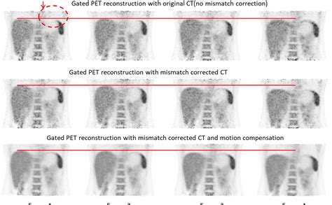 Figure 2 From Automatic Mismatch Correction And Motion Compensation For