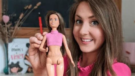 Una Madre Diseñó Una Muñeca Barbie Con Estrías Para Su Hija Con El Fin