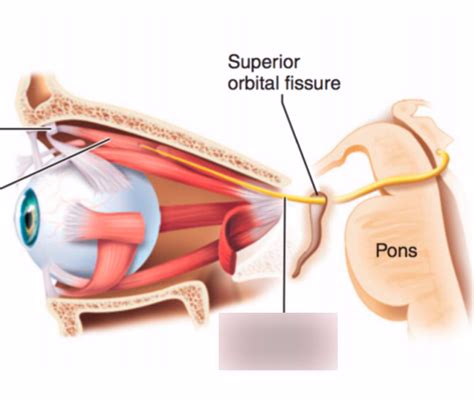 Trochlear Nerve