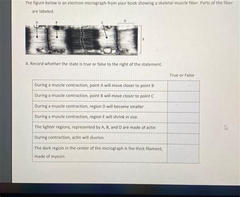 [solved] The Figure Below Is An Electron Micrograph From Y
