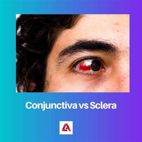 Conjunctiva Vs Sclera Difference And Comparison
