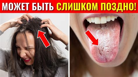 🚨 11 Критических Симптомов Рака Поджелудочной Железы Которые Нельзя Игнорировать Youtube