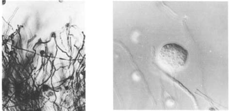 Pythium Insidiosum From A Slide Culture Of Cornmeal Figure 4 Pythium Download Scientific