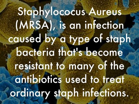 Staphylococcus Aureus Mrsa By Monet Chisholm