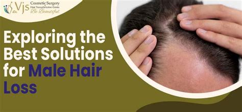 Hair Loss Treatments For Men In India