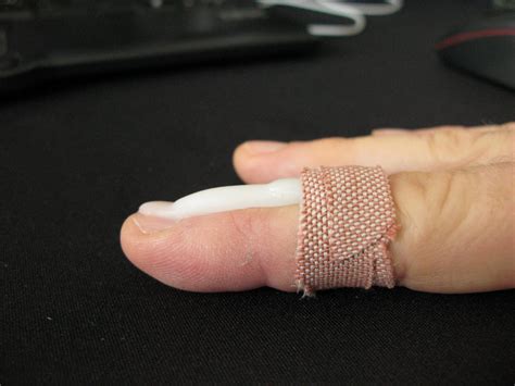 Custom Finger Tip Splint