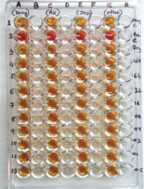 Microbroth Dilution Antibiotic Susceptibility Testing Of Ureaplasma Download Scientific Diagram