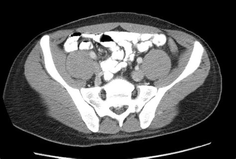 Untitled Document Anatomy Host Dartmouth Edu