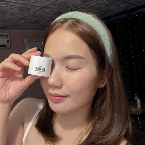 ဝက်ခြံ၊တင်းတိပ်၊အမဲစက်၊ချွေးပေါက်ကျယ်၊ဆားဝက်ခြံပျောက်ချင်သူများစုံစည်းရာ