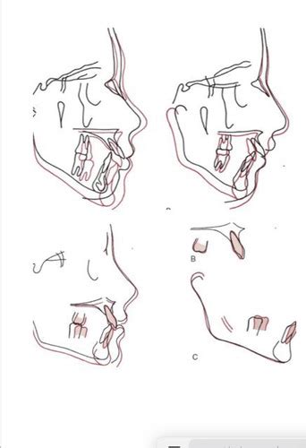 2 Ceph Tracing And Analysis Flashcards Quizlet