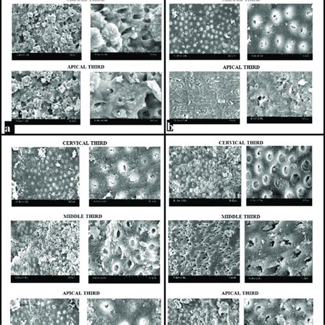 Comparison Of Smear Layer Removal Between Different Groups Download Scientific Diagram